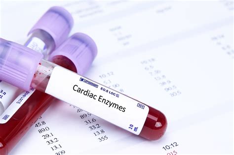 Cardiac Enzyme Tests For Early Heart Attack Detection