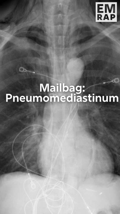 Em Rap Inc On Linkedin Emrapshow Medicaleducation Emrap Em Emergencymedicine Er…