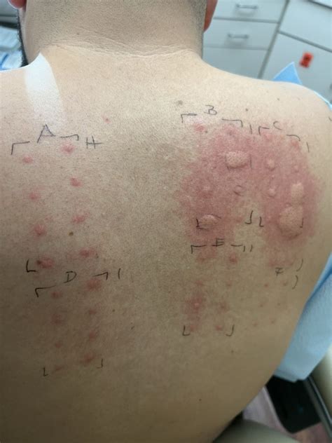 Nick Debnath Md Facs Updated December 2025 10 Reviews 7251 University Blvd Orlando