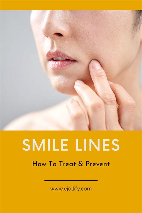 How To Get Rid Of Smile Lines Aka Nasolabial Folds Artofit
