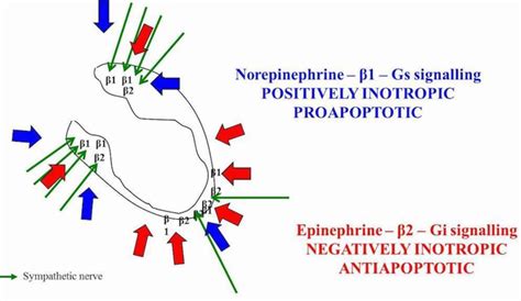 Takotsubo Cardiomyopathy Causes