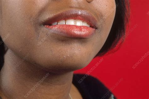 Female Mouth And Chin Stock Image C003 4460 Science Photo Library