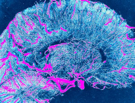Brian Owens Image Brain Vasculature