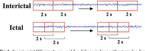 Figure 1 From One Dimensional Convolutional Neural Networks For Seizure Onset Detection Using