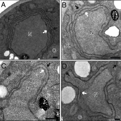 Morphology And Number Of Double Membrane Layers Is Altered In Triple