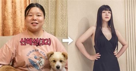 21kg 감량 신혜선 수영복까지 입고 환골탈태살 빼니 성형 효과