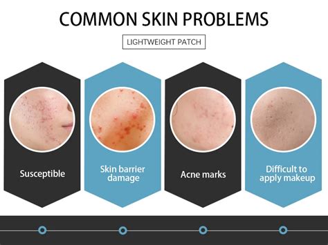 Micro Needling Pimple Patch Best For Cystic Acne