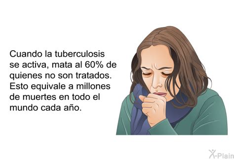 Tuberculosis