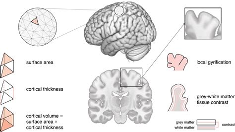 Frontiers Structural Neuroimaging Phenotypes And Associated Molecular