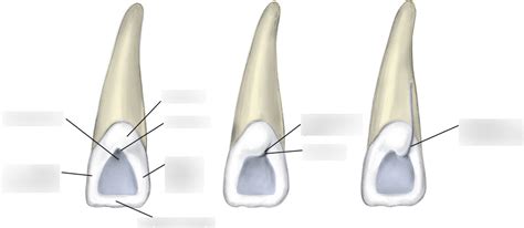 Variations Of The Lingual Surface Of The Permanent Maxillary Right Lateral Incisor Diagram Quizlet