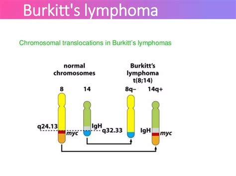 Epstein Barr Virus Ppt