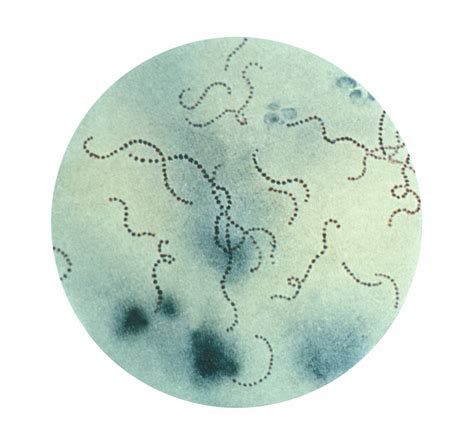 Public Domain Picture A Photomicrograph Of Streptococcus Pyogenes