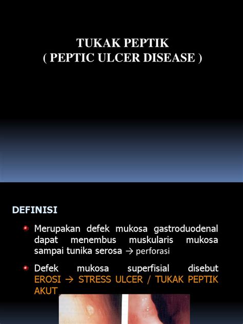 Ulkus Peptikum Pdf