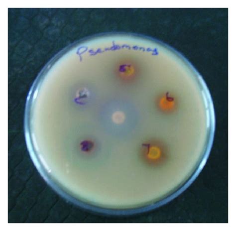 The Inhibition Zones Formed For Pseudomonas Aeruginosa And Candida Download Scientific Diagram