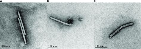 Representative Transmission Electron Microscopy Micrographs Of Pepper Download Scientific