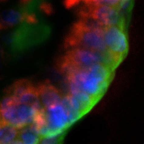 The Off Patent Drug That Could Protect Us From Future Covid 19 Variants