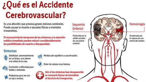 El Accidente Cerebrovascular Y Su Rehabilitación Consejo Al Día