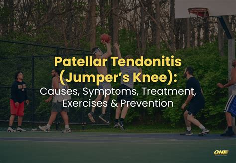 Patellar Tendonitis Jumpers Knee Causes Symptoms Treatment