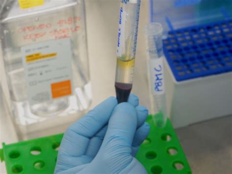 Video A Flow Cytometry Based Cytotoxicity Assay For The Assessment Of Human Nk Cell Activity