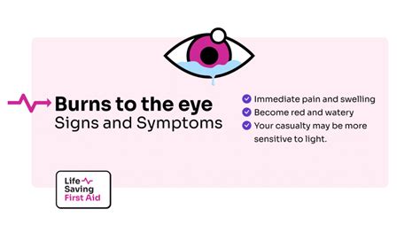Eye Injuries Life Saving First Aid