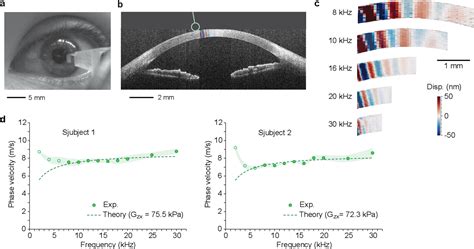Figure 2 From In Vivo Optical Coherence Elastography Reveals Spatial