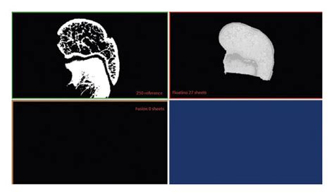 Spatial Transformation Of Reference Image Download Scientific Diagram