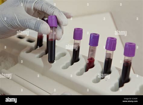Blood Hi Res Stock Photography And Images Alamy