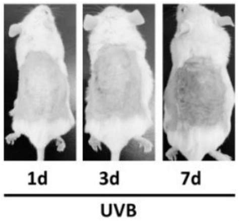 Application Of Fibroblast Growth Factor Fgf21 To Preparation Of Drug