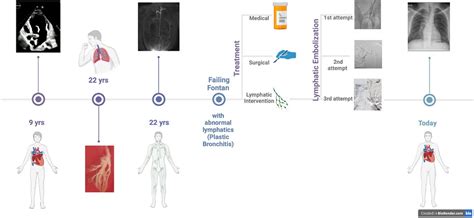 Lymphatic Abnormalities In Fontan Case Report Of Plastic Bronchitis Jacc Case Reports