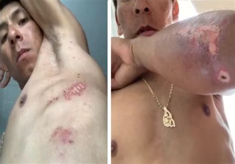 VIDEO El Inhumano Sufrimiento De Nairo En El Tour