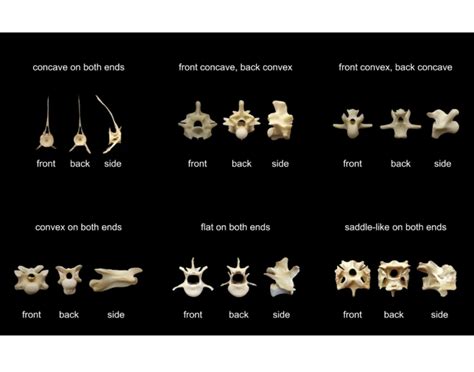 Types Of Vertebrae And Examples Quiz
