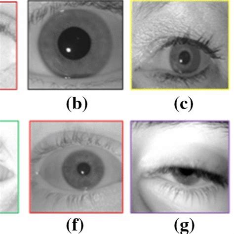 Unconstrained Iris Images A Reflection B Motion Blur C Contrast Download Scientific Diagram