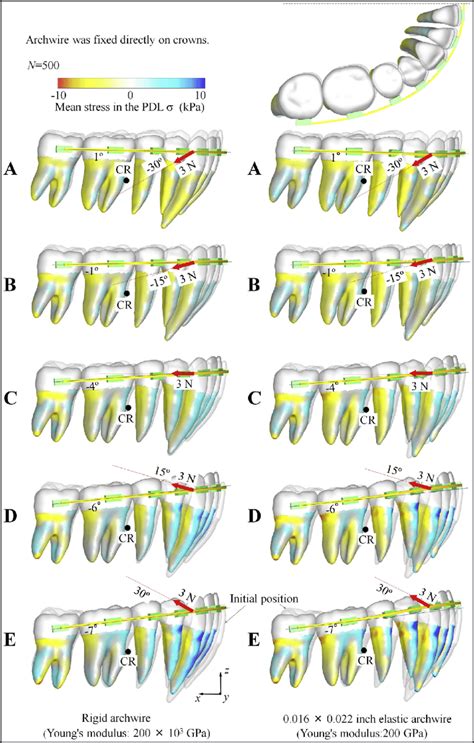 Tooth Movement Patterns At N 5 500 For 5 Force Angulations To The