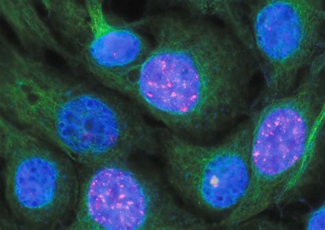 3d Structured Illumination Microscope Keyence America