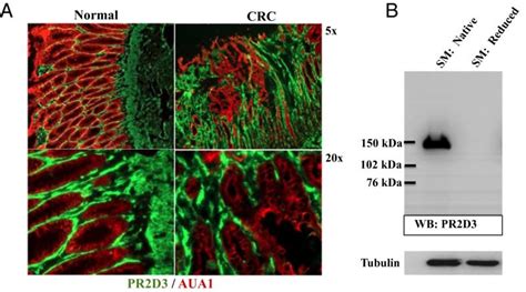 Anti Myofibroblast Marker Pr 2d3 Monoclonal Antibodies Ximbio