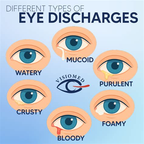 Visiomed 👁️ Ever Noticed Unusual Eye Discharge Heres What Different Types Might Mean 👇 💧