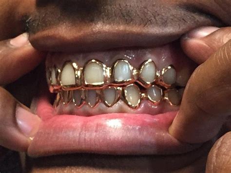 Pin By Louis On Enregistrements Rapides Grills Teeth Grillz Gold Teeth