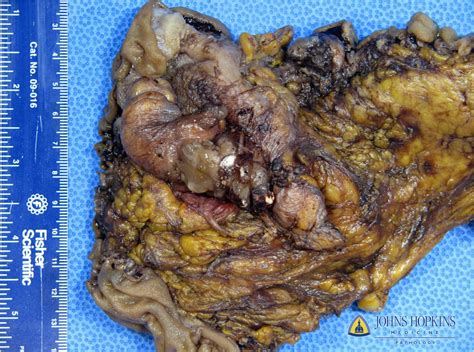 Lamn Surgical Pathology Photo Website