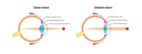 Eye Accommodation Poster Stock Illustration Download Image Now