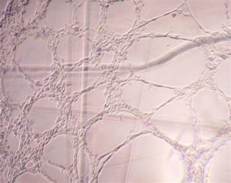 Angiogenesis Analyzer Converge Error Image Analysis Imagesc Forum