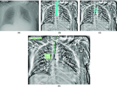 Visualizations Of The Nodes Involved In The Knowledge Supported Machine