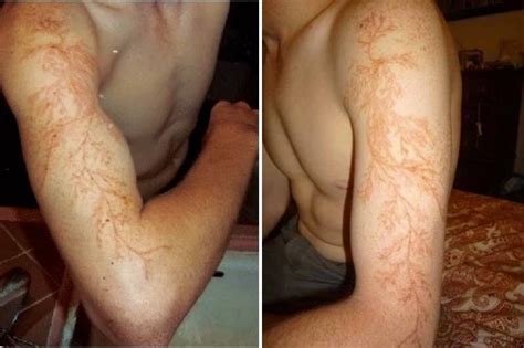 10 Menschen vom Blitz getroffen wurden und überlebten Gunsti