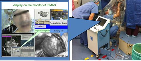 Iemas Intraoperative Examination Monitor For Awake Surgery