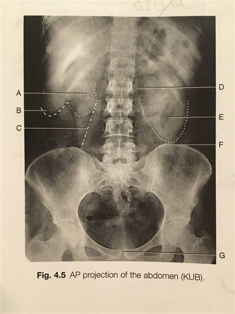 Abdomen Diagram Quizlet