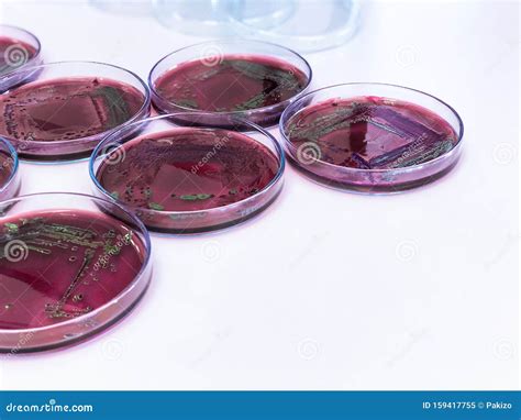 Escherichia Coli Li Cultured With Eosin Methylene Blue Emb Agar In