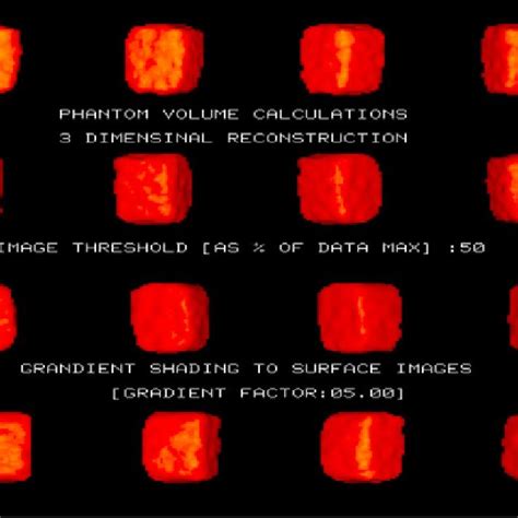 3d Spect Phantom Images 3dimensional Reconstruction Volume