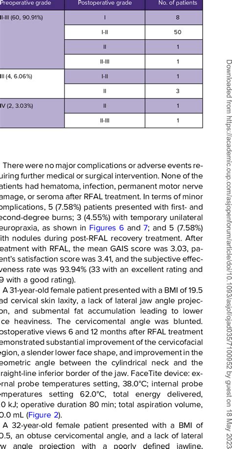 Results Of Knize Scale Grading Of Cervicomental Angle Between