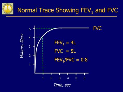 Spirometry Normal Rate At Amy Barnes Blog