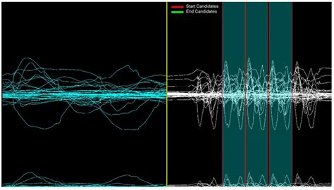 A Time Scalable Posture Detection Algorithm For Paraplegic Patient Rehabilitation Using