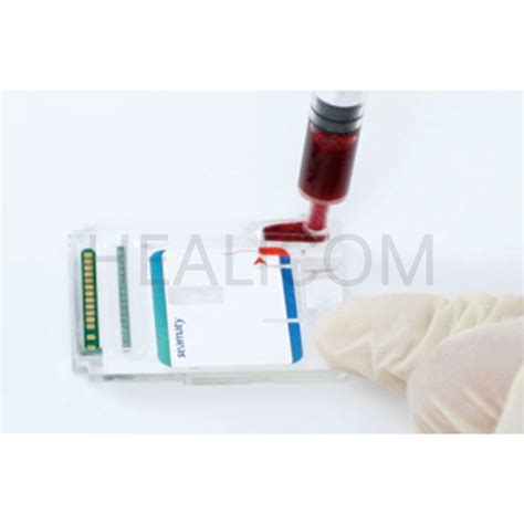 Sg1 Laboratory Equipment Portable Easy Operate Handheld Electrolyte Analyzer From China